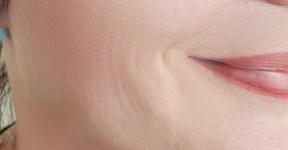 Gallery - Prime Aesthetics